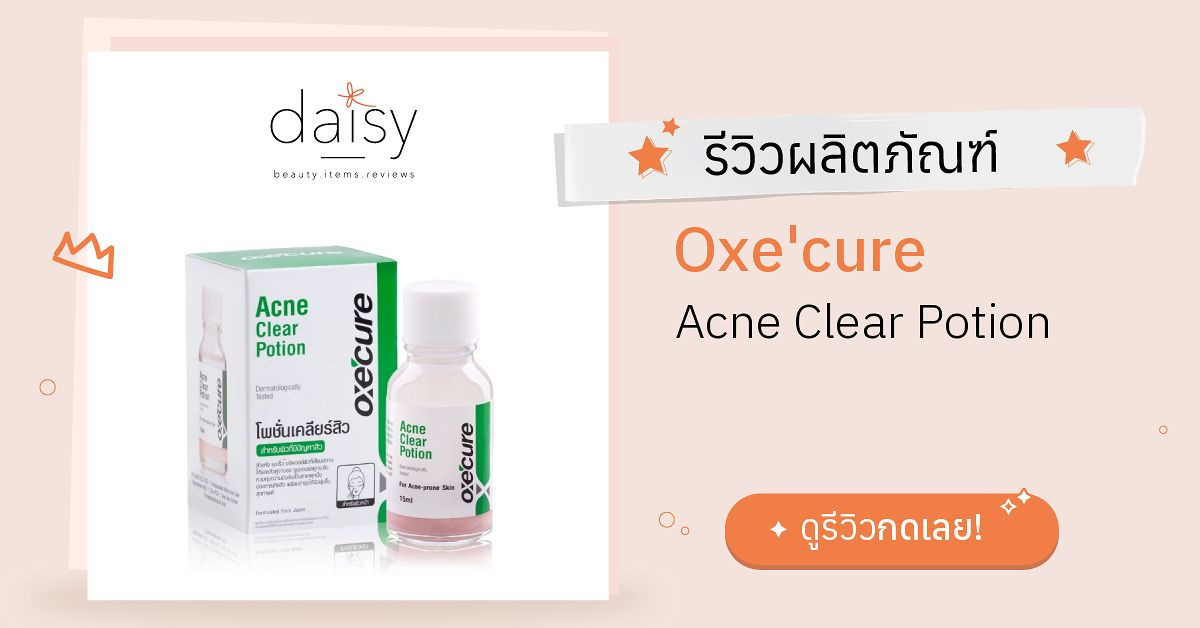 Review Oxe'cure Acne Clear Potion ริวิวผลการใช้โดยสมาชิก - Daisy by ...